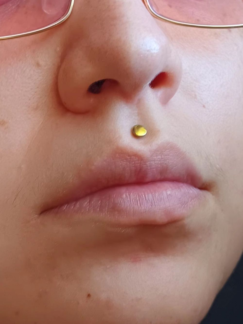 Invictus Implant Grade Titanium Threadless Disc Ends