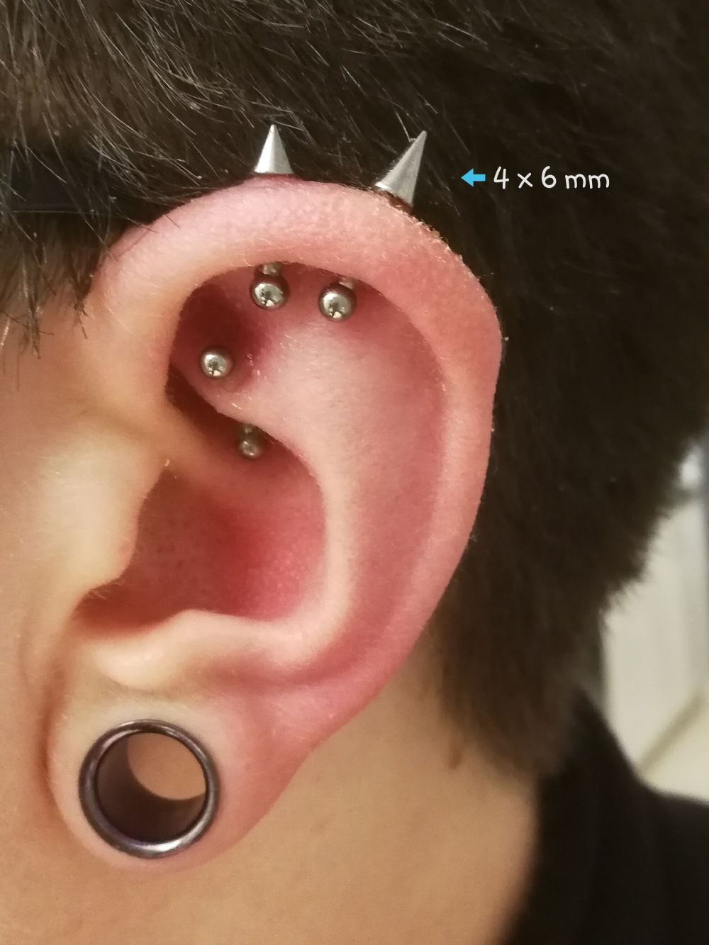 Titanium Internally Threaded Spike End