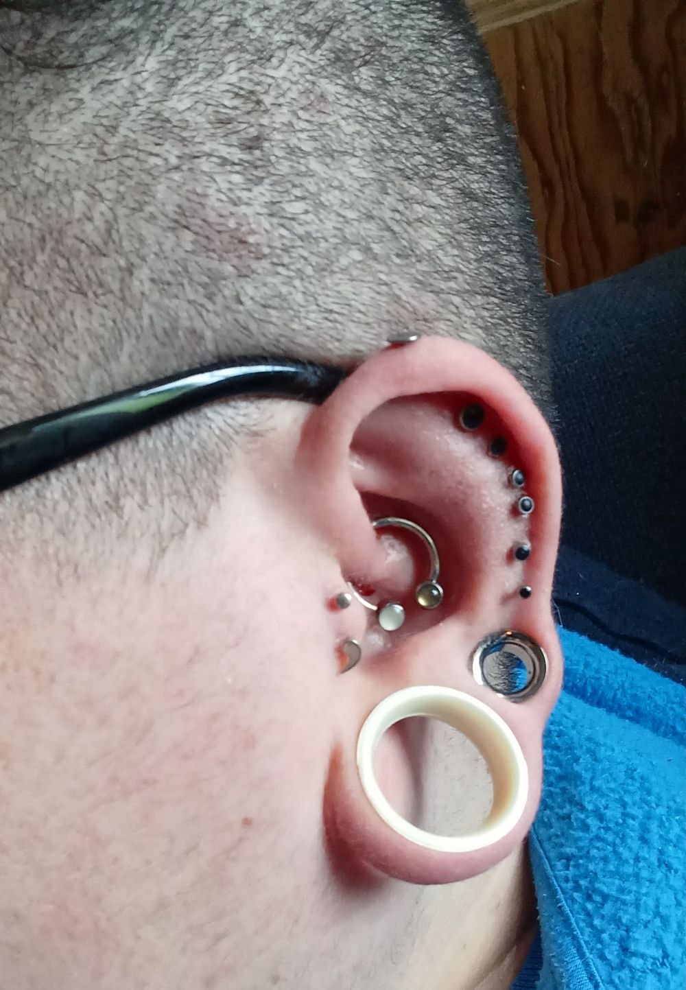 Titanium Internally Threaded Eyelet