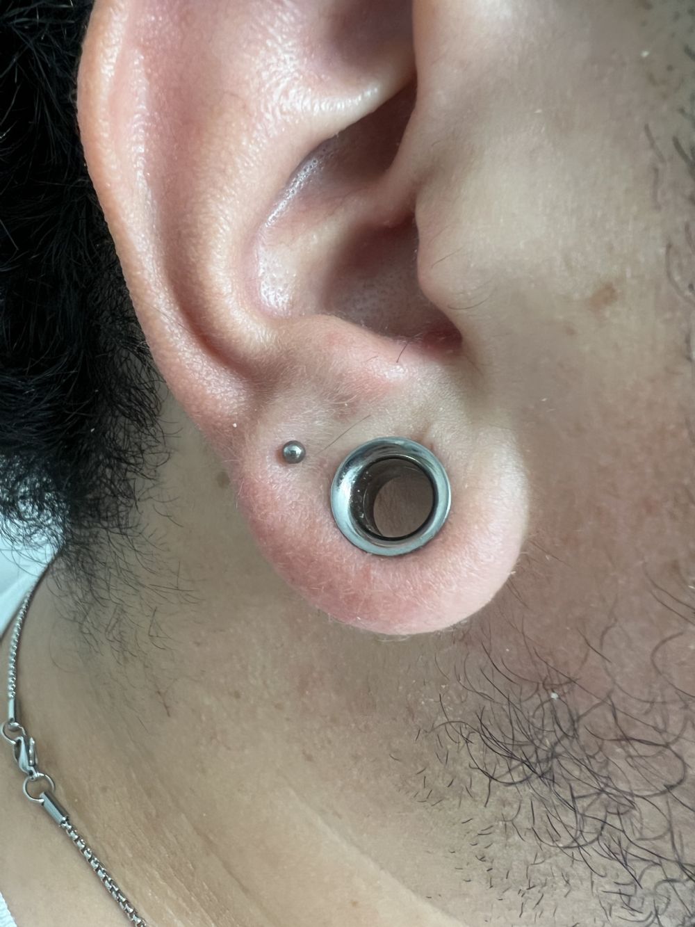 Titanium Internally Threaded Eyelet