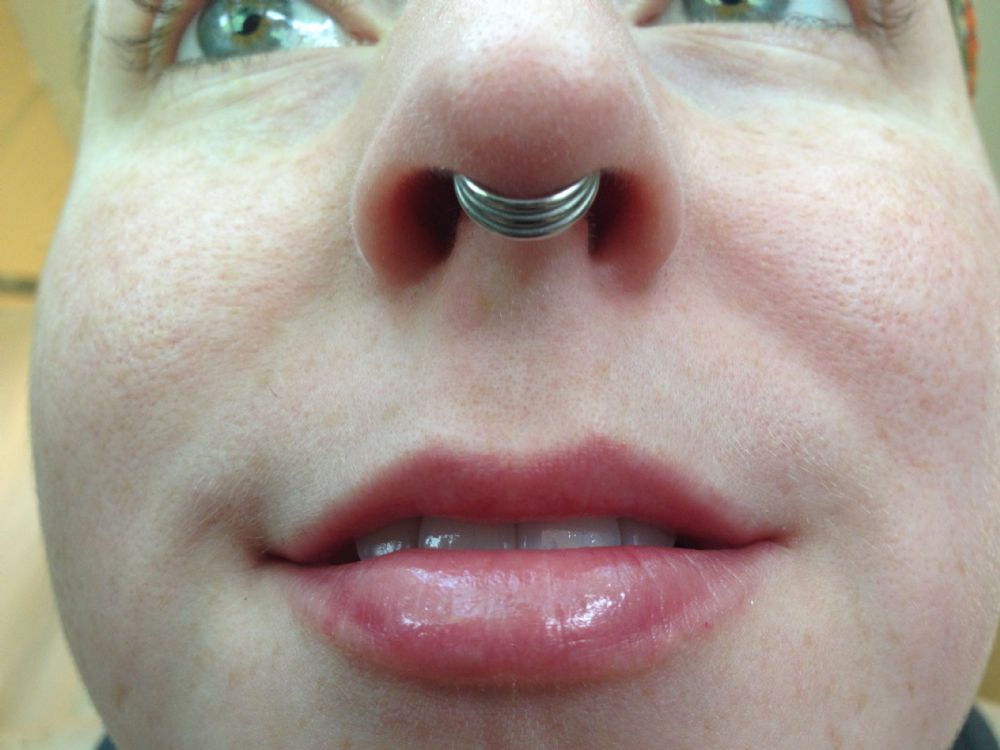 Three Band Septum Clicker