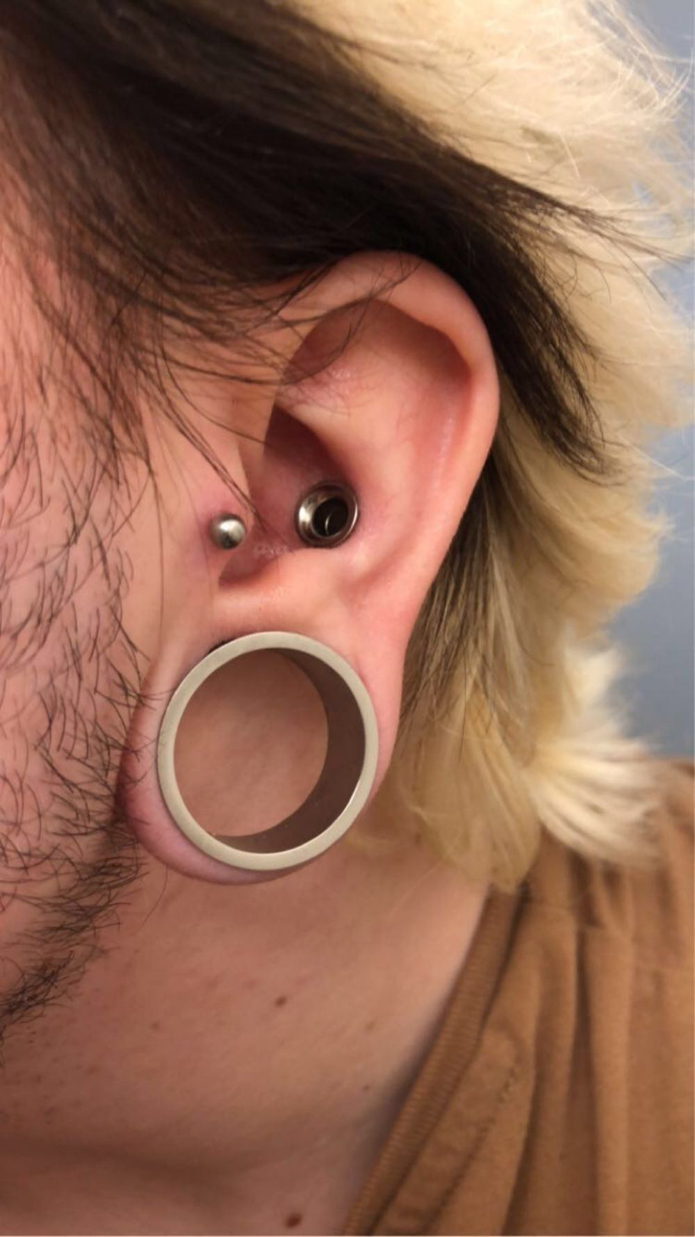 Titanium Internally Threaded Eyelet