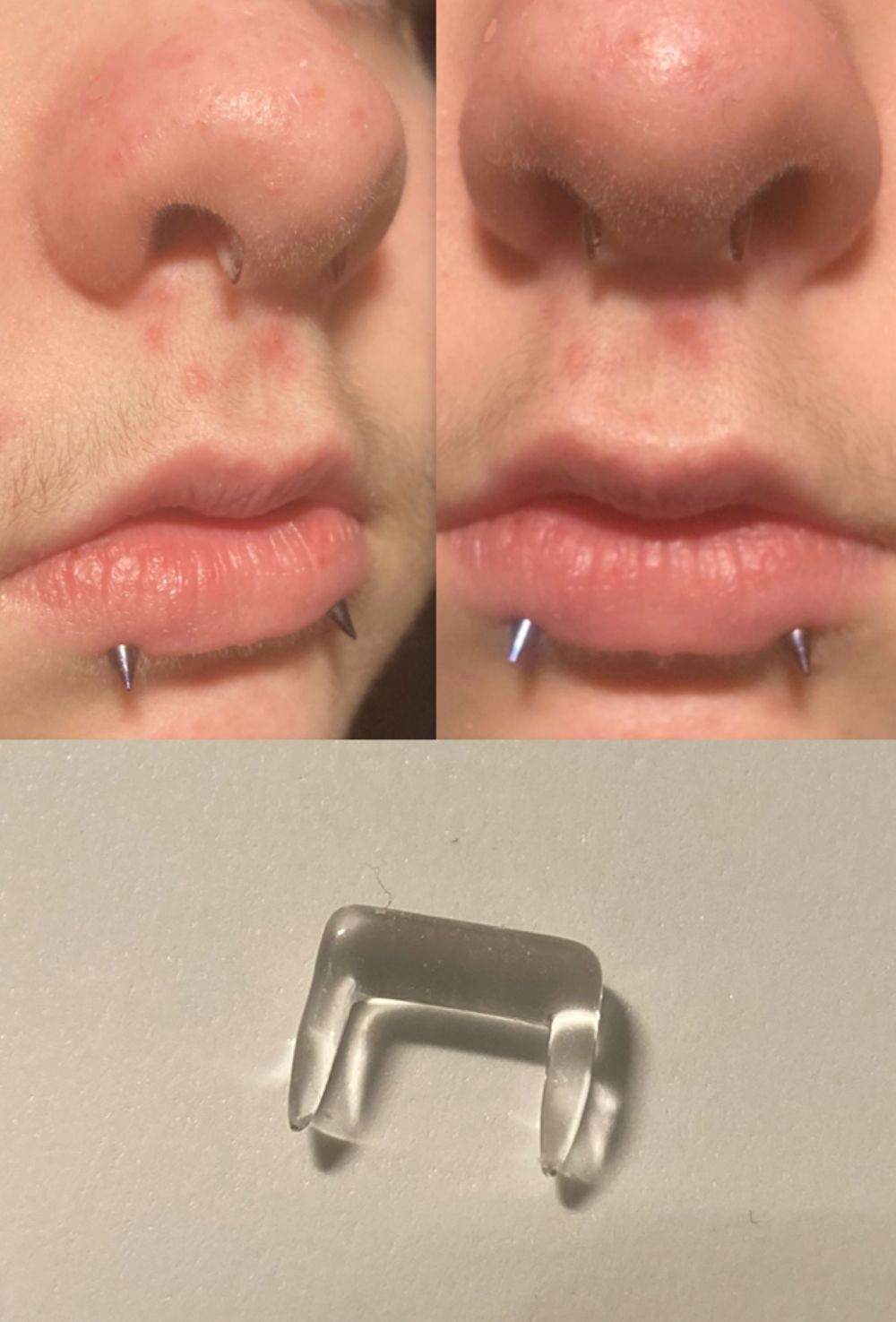 Custom Order Glass Septum Retainer By Gorilla Glass