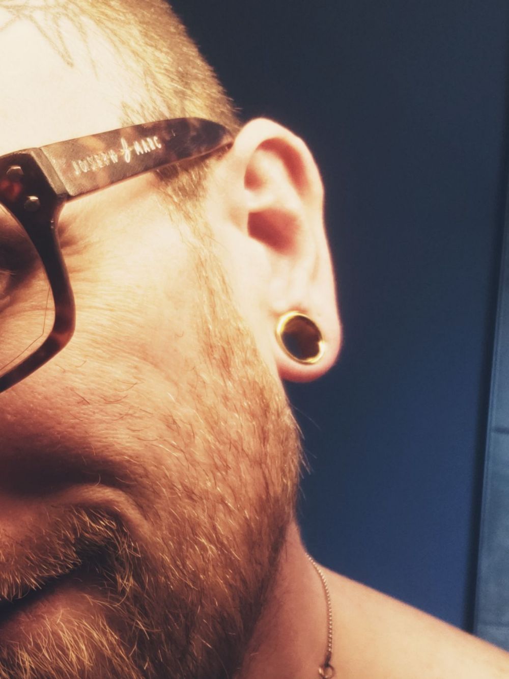 Pre-order Titanium Eyelet - Anatometal