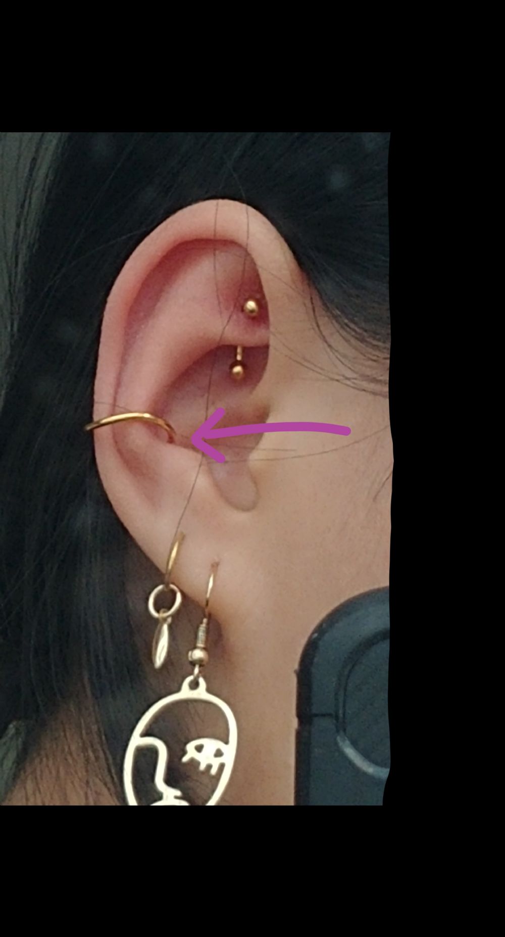 Fixed Bead Captive Ring