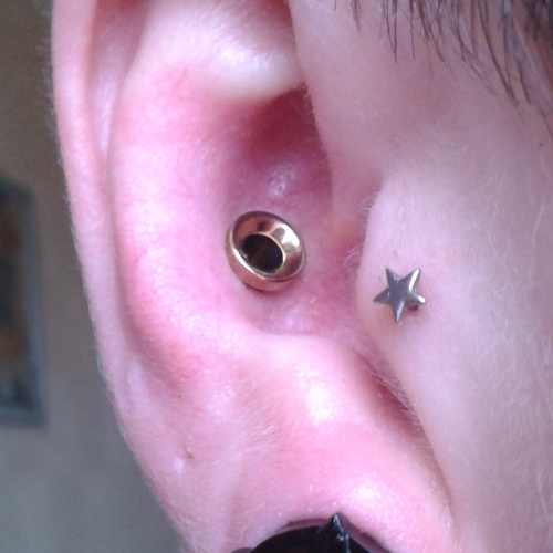 Pre-order Titanium Eyelet - Anatometal