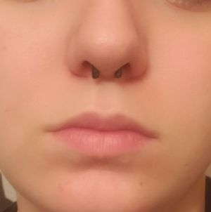 Steel Staple Septum Retainer